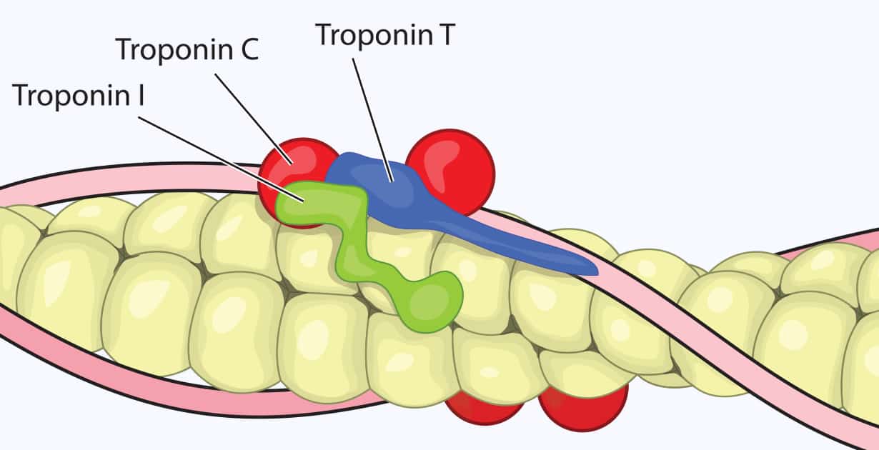 Troponin Test Kit Nhanh Ph t Hi n Troponin I